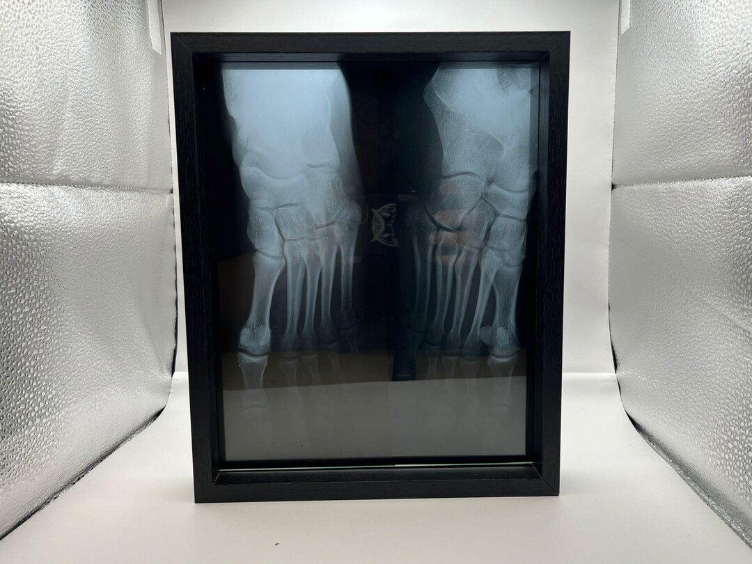 X-ray in Frame Feet Double Xray Human Bones Oddity Curiosities Oddity ...