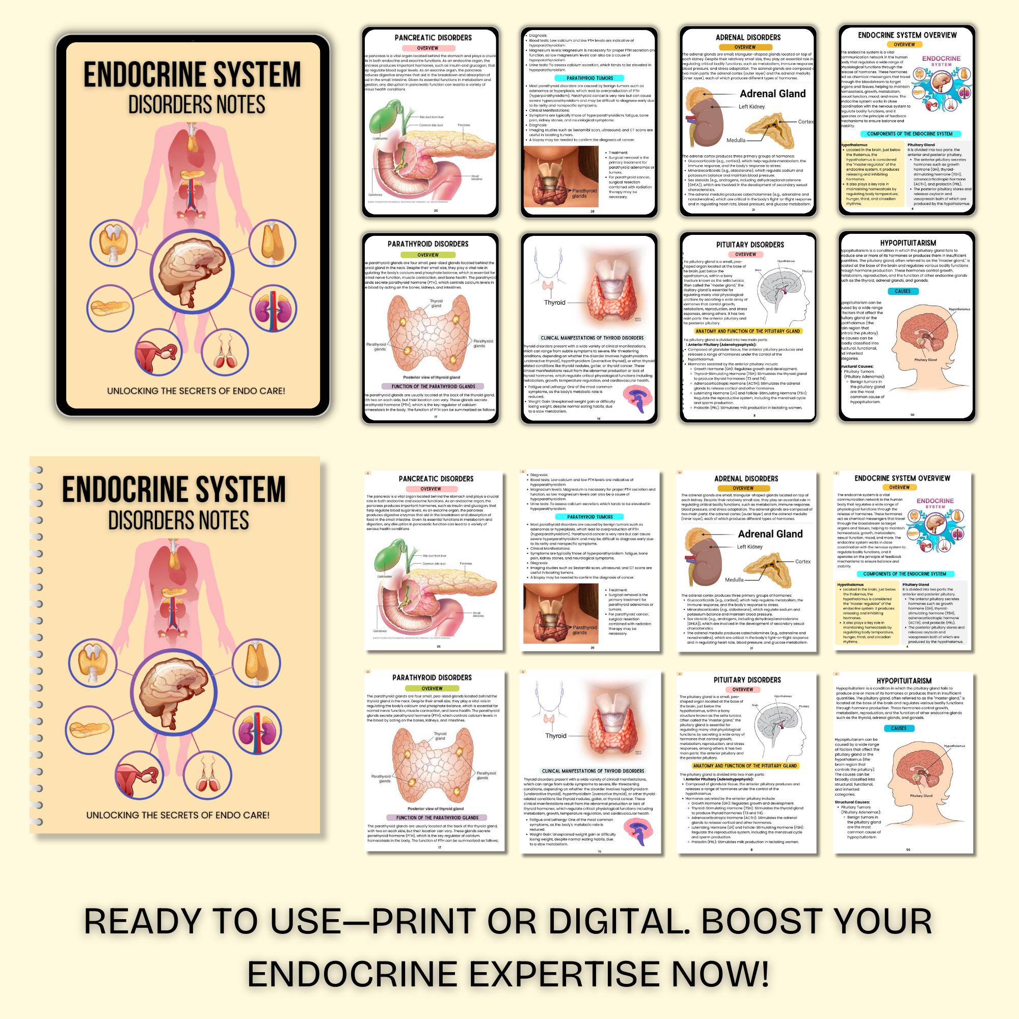 Endocrine Notes | Endocrine System Disorders | Nursing Bundle | PDF - Etsy