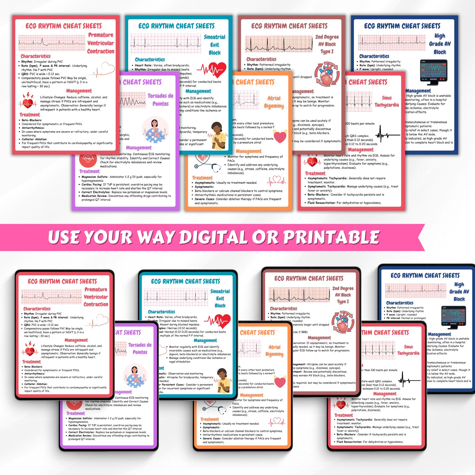 ECG Rhythm & Arrhythmias Cheat Sheets Bundle | EKG Interpretation ...