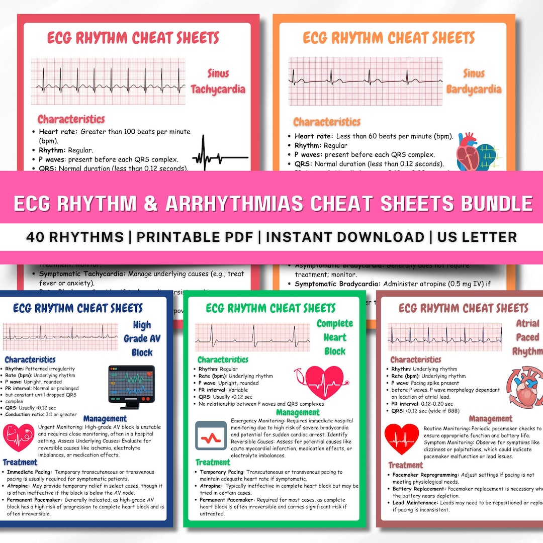ECG Rhythm & Arrhythmias Cheat Sheets Bundle | EKG Interpretation ...