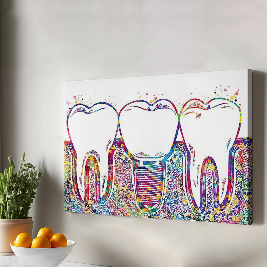 Colorful Dental Implants Dentist Art, İllustration Modern Wall Decor ...