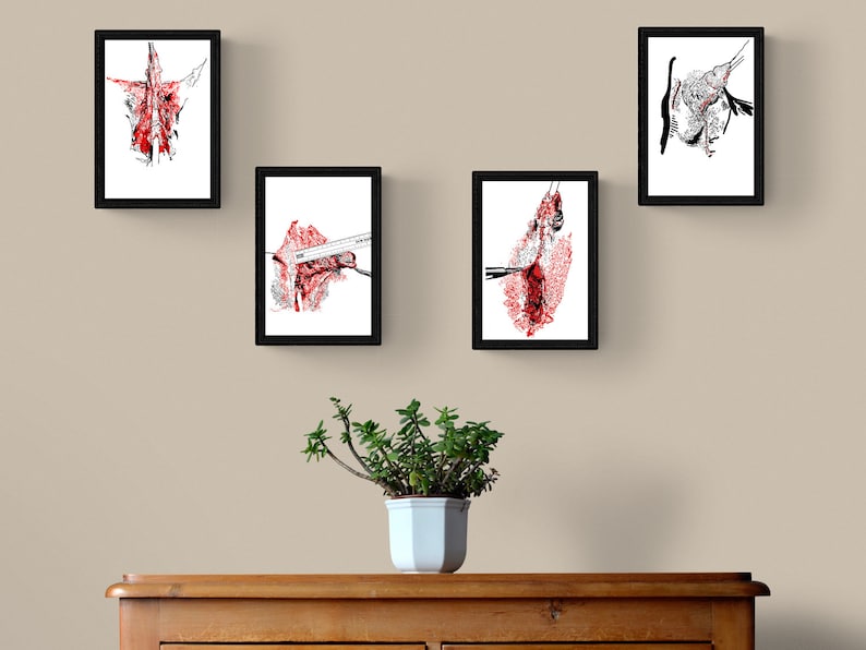 FTM /non-binary Trans Surgery Print: Metoidioplasty #2 (single, Black ...