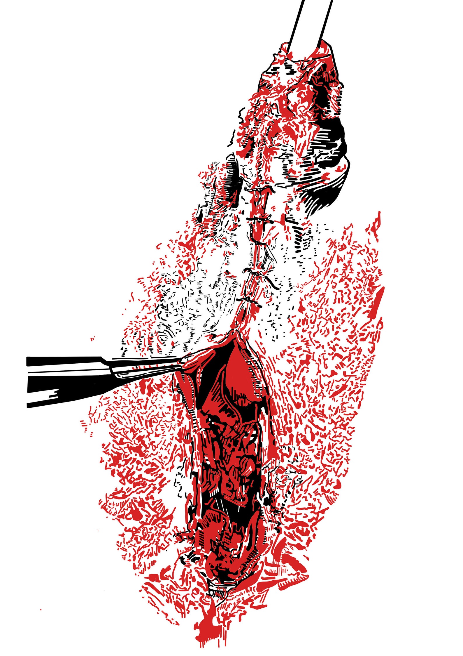 FTM /non-binary Trans Surgery Print: Metoidioplasty #3 (single, Black ...