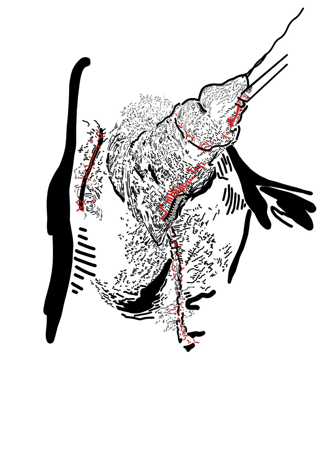 FTM /non-binary Trans Surgery Print: Metoidioplasty #4 (single, Black ...