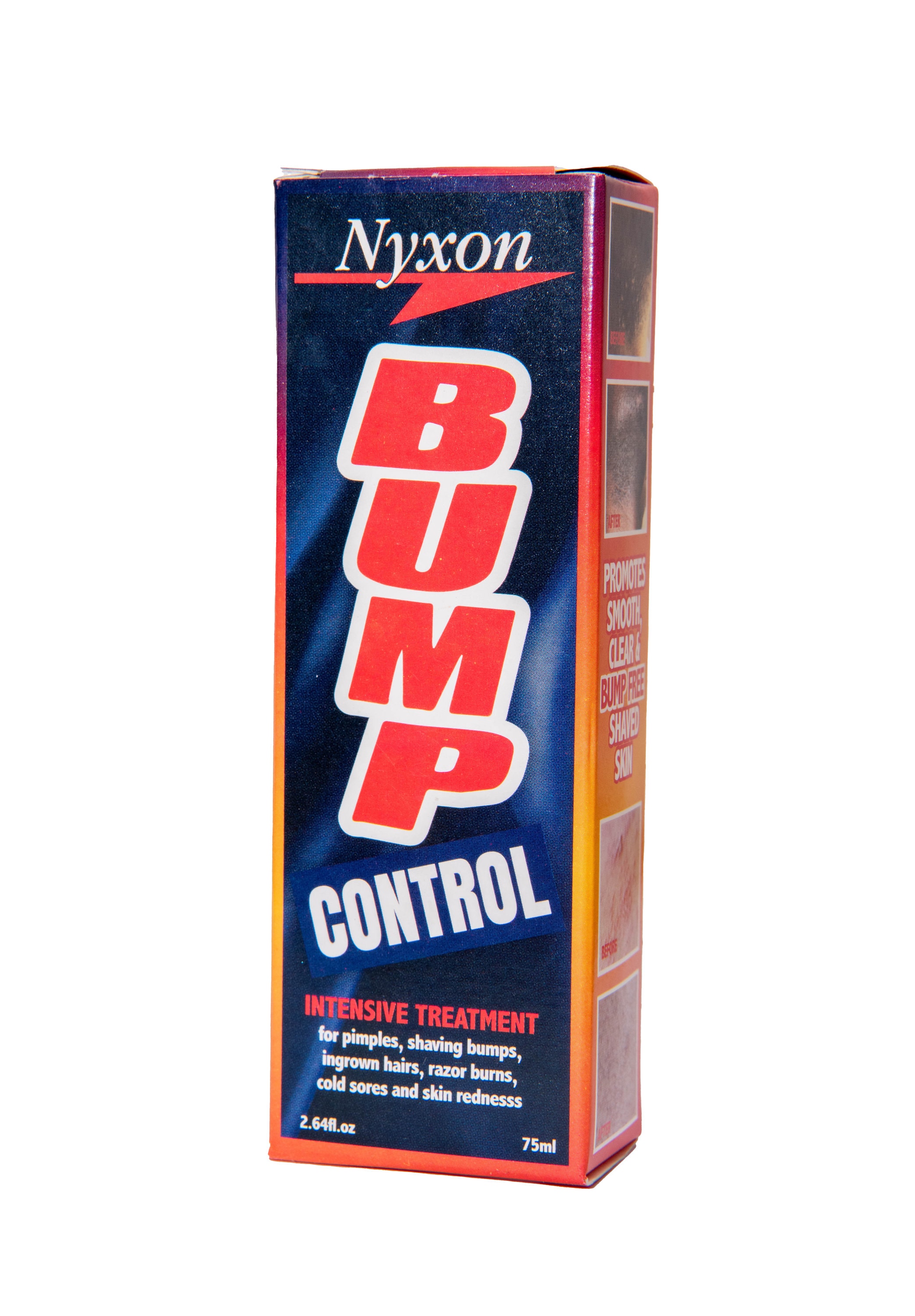 Nyxon Bump Control - Etsy