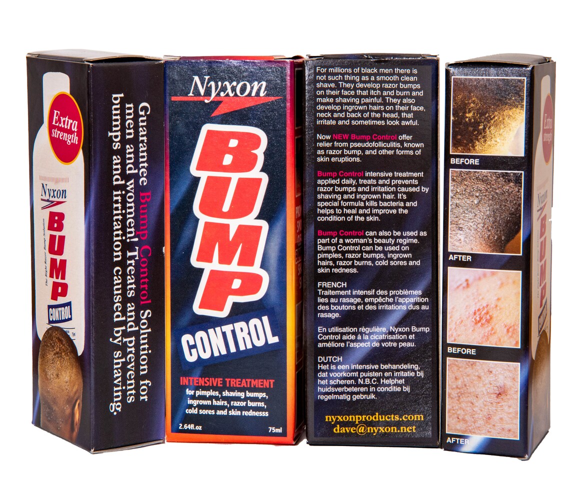 Nyxon Bump Control - Etsy