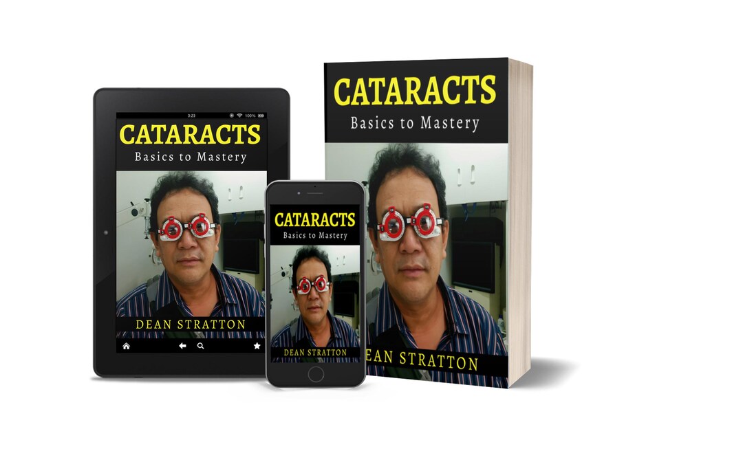 Cataracts - Basics to Mastery | Clear-view Guide to Diagnosis, Lens ...