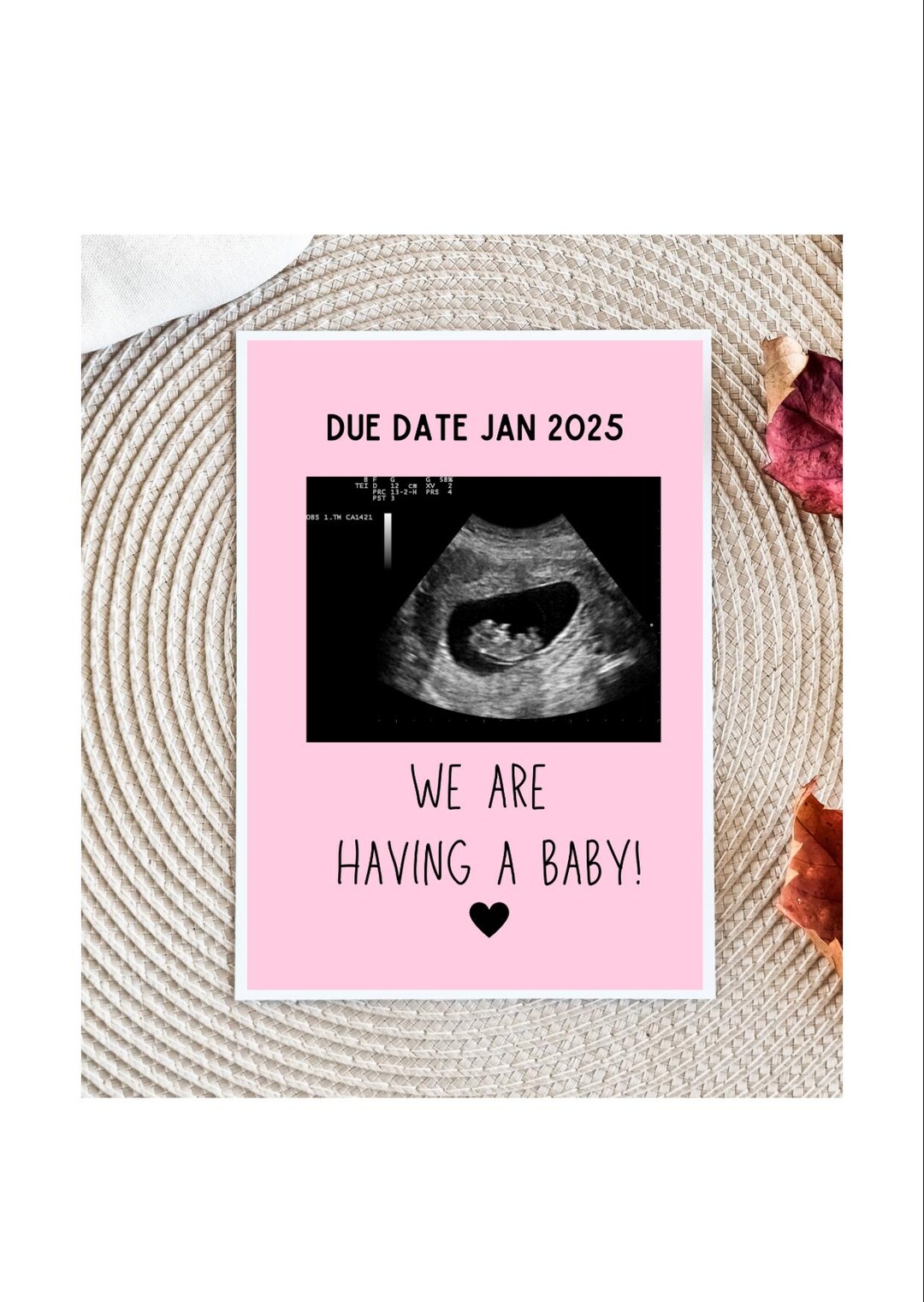 Personalized Custom Baby Scan Announcement Cards, New Baby Announcement ...