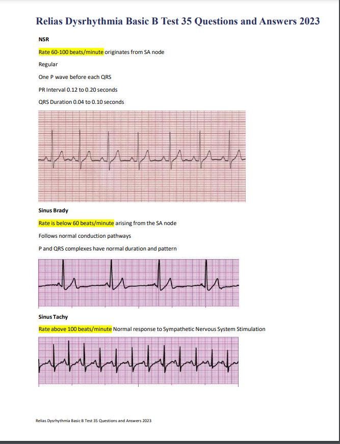 Relias Dysrhythmia Basic B Test 2023 Review Questions and Answers - Etsy