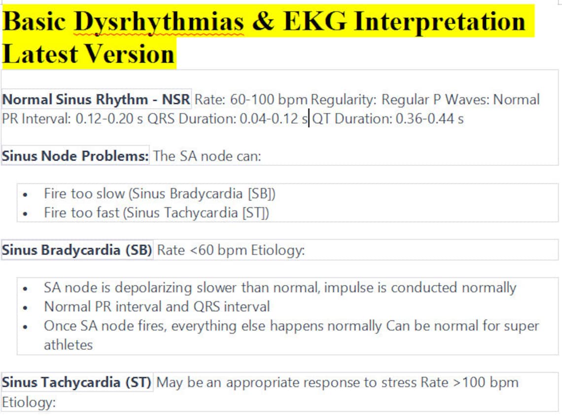 Basic Dysrhythmias and EKG Interpretation Guide 2024 - Etsy