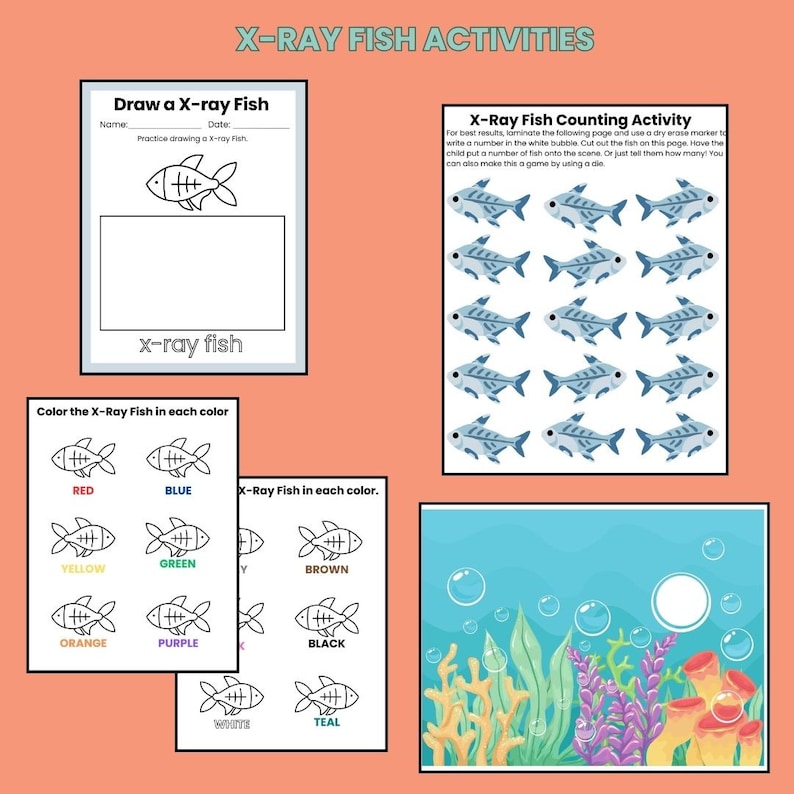 X-ray Fish Preschool Kindergarten Activity Sheets Bundle X is for X-ray ...