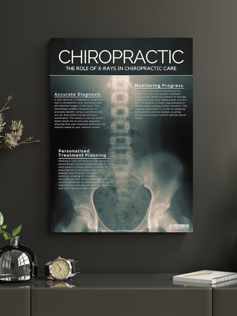 Chiropractic X-ray Educational Poster - Etsy