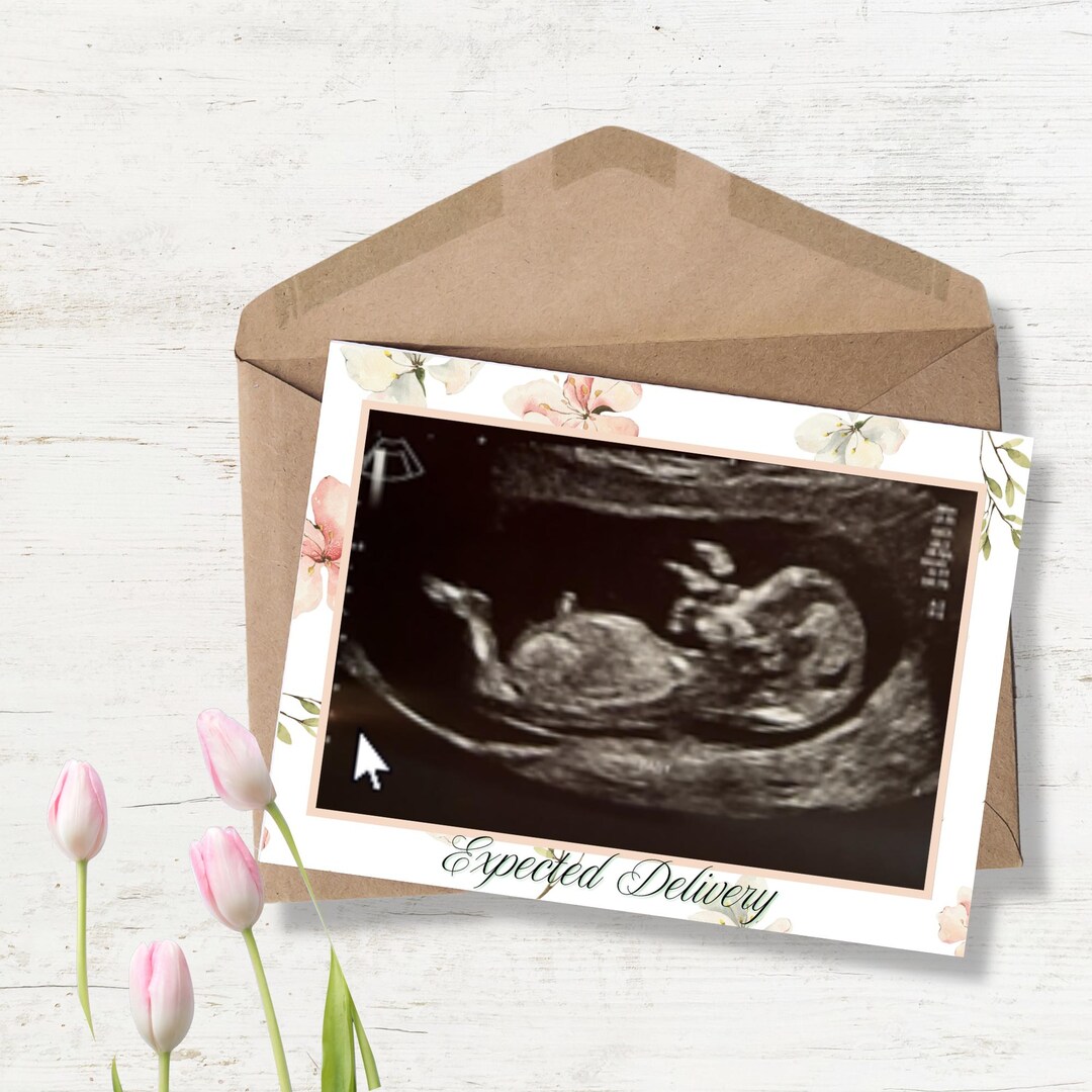 Spring Baby Announcement Template, Personalized Baby Reveal With ...