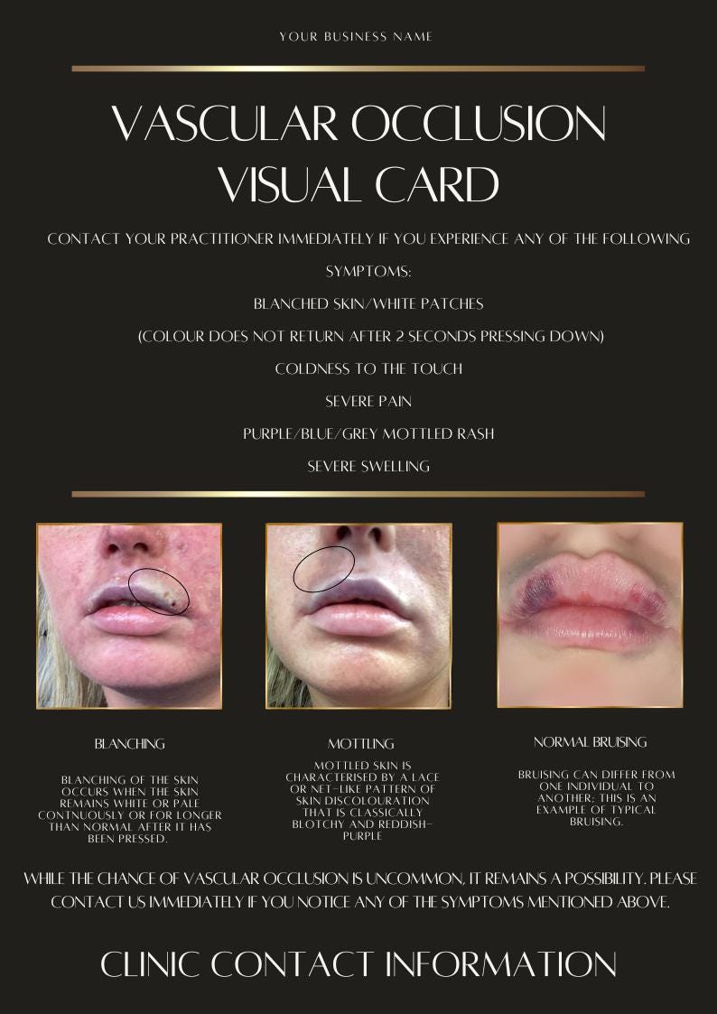 Vascular Occlusion Card - Etsy