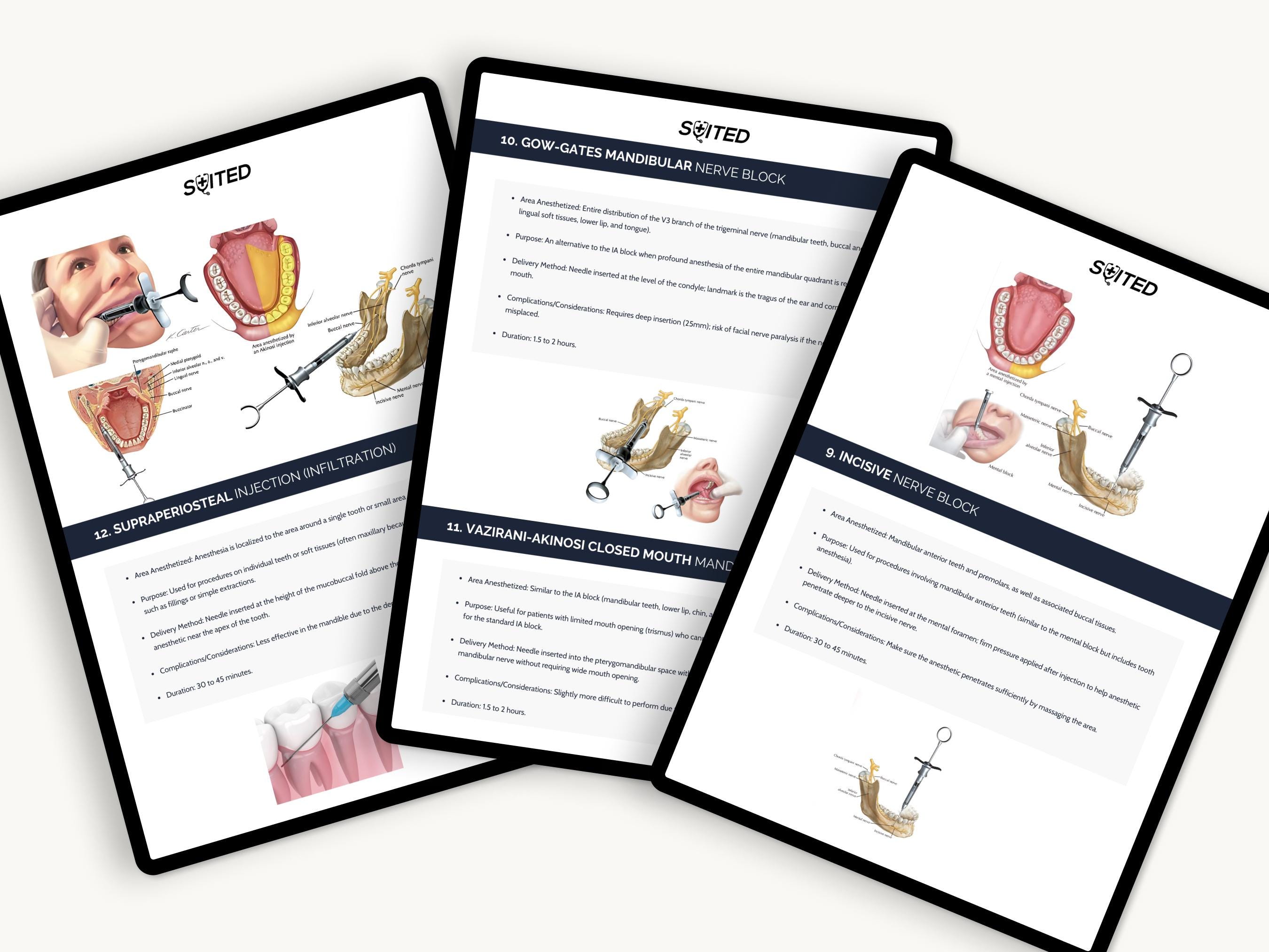 Anesthesia Made Easy: Quick Reference for Dental Hygienists -digital ...