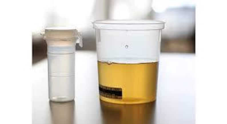 The Business of DOT Urine Specimen Collection - Etsy
