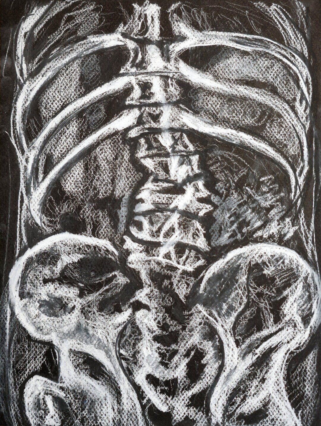 Spine Anatomy X-ray Art Print 11 X 14 Inches, Skeleton, Horror, Medical ...