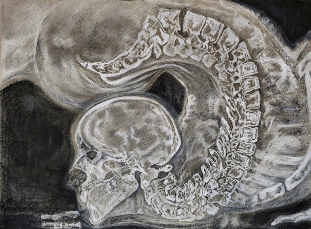 Contortionist X-ray Art Print 11x14 Inches, Dark Art, Gothic, Horror ...