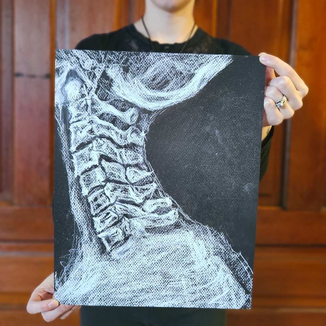 Vertebrae Anatomy X-ray Art Print 11 X 14 Inches, Skeleton, Horror ...