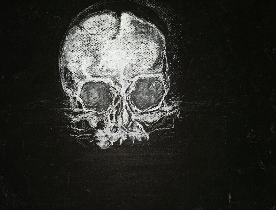 Skull X-ray Art Print 11 X 14 Inches, Skeleton, Dark Art, Gothic ...