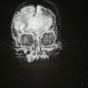 Skull X-ray Art Print 11 X 14 Inches, Skeleton, Dark Art, Gothic ...