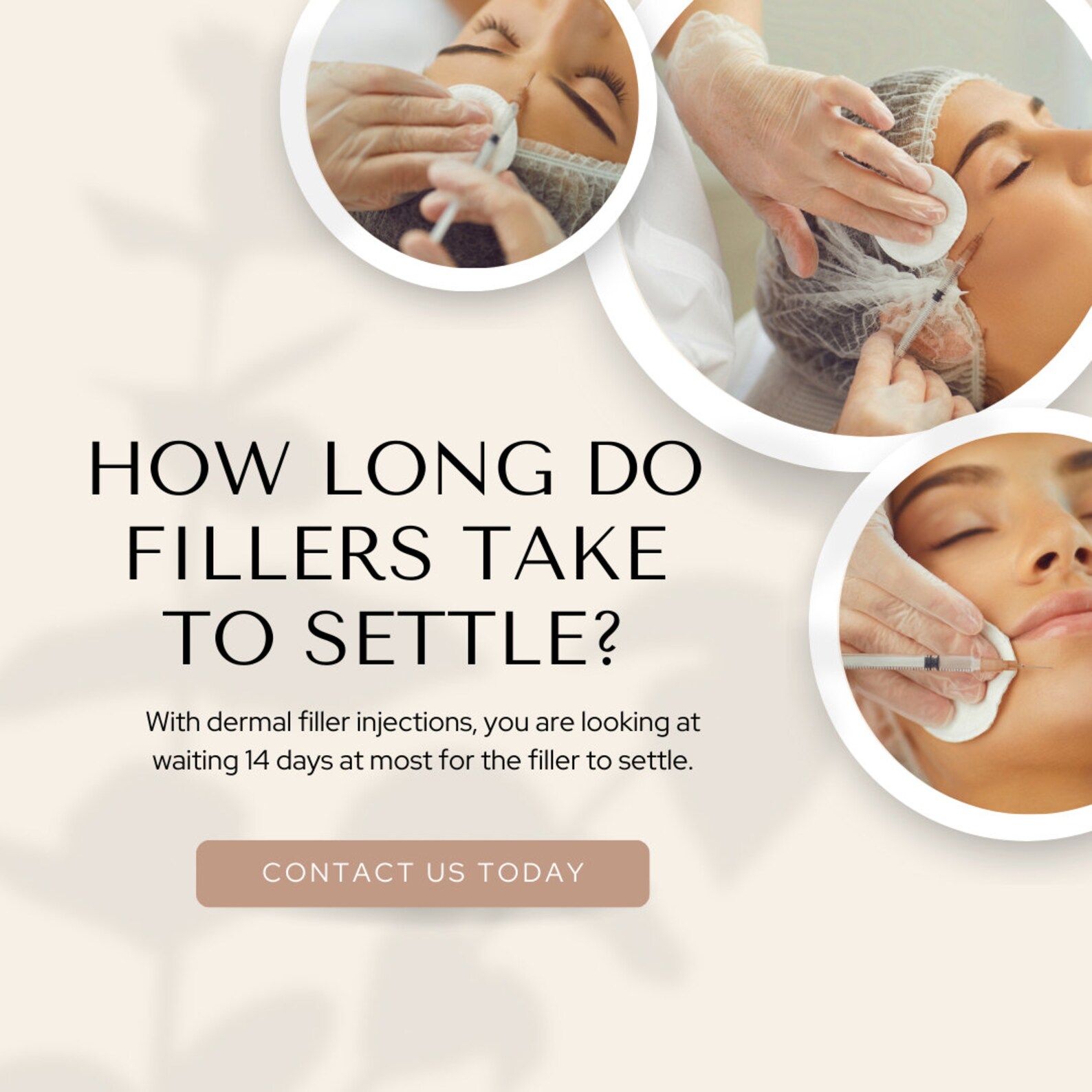 50 Botox and Filler Instagram Posts, Nurse Injector Instagram Templates ...