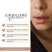 50 Botox and Filler Instagram Posts, Nurse Injector Instagram Templates ...