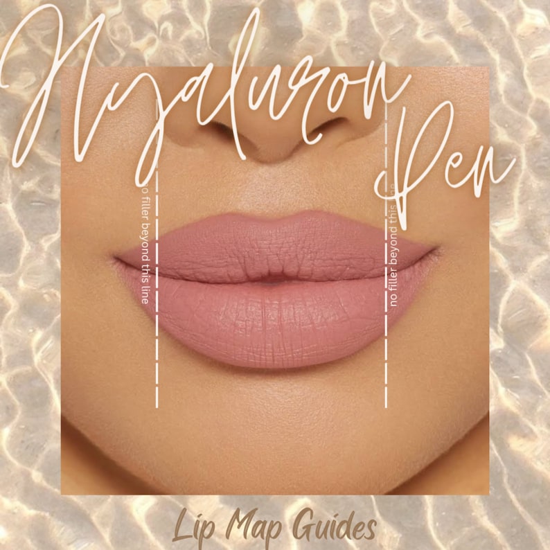 Hyaluron Pen Lip Mapping, Dermal Lip Fillers, Lip Maps, Russian Lips ...