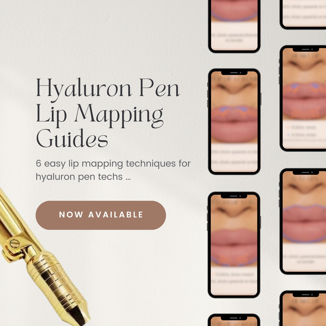 Hyaluron Pen Lip Mapping, Dermal Lip Fillers, Lip Maps, Russian Lips ...