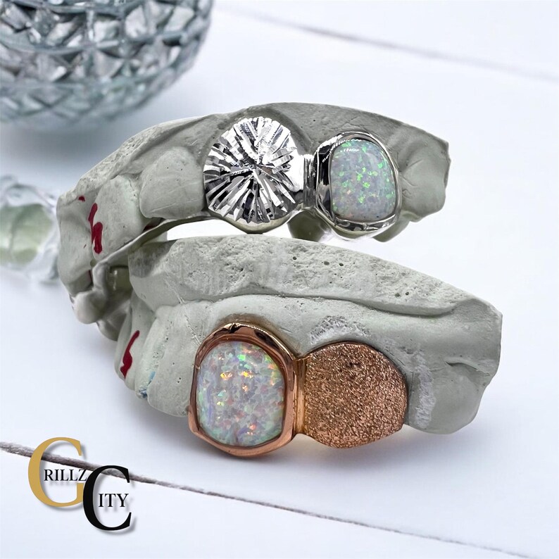 Custom Fitted Grillz, 10k 14k 18k Gold or 925 Silver Opal, Open Face ...