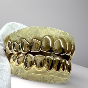 Custom Real Gold Teeth Permanent Grillz / 925 Silver Solif Permanent ...