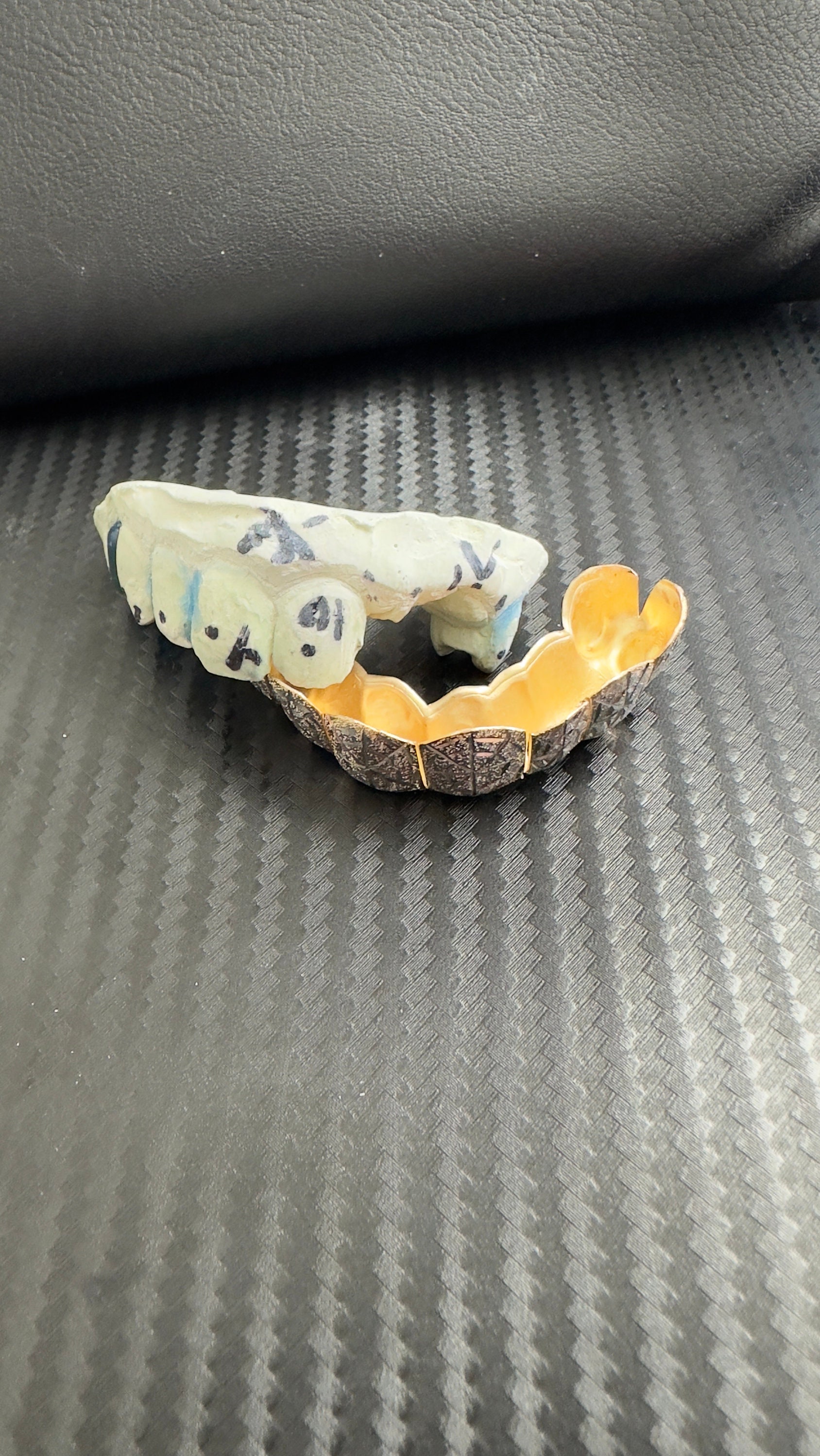 Custom Real Gold Teeth Permanent Grillz / 925 Silver Solif Permanent ...