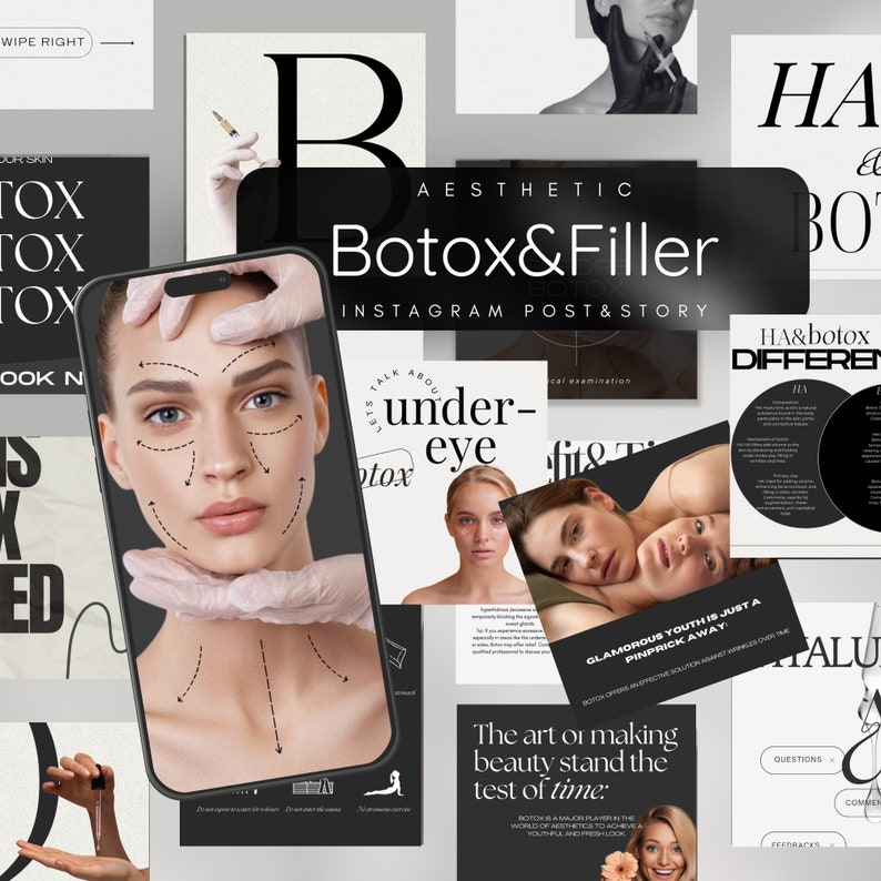 Botox and Filler Instagram Templates, Nurse Injector Templates ...