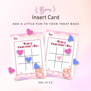 Valentine Printable Treat Bag Topper Kids Classroom Valentines Favor ...