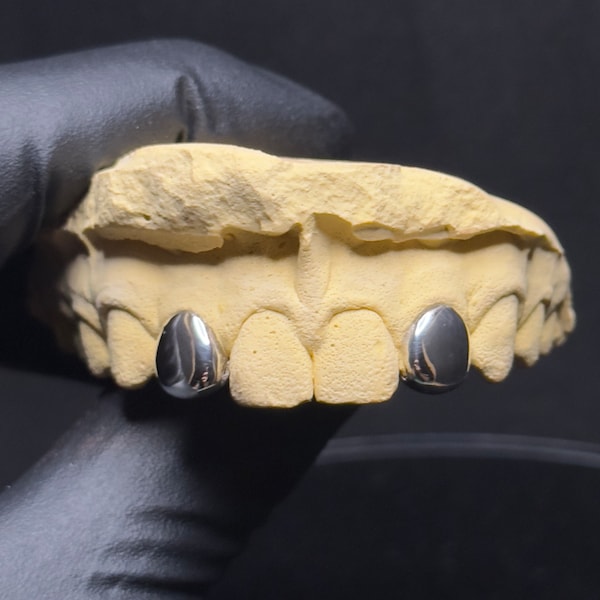 Silver Cap Teeth - Etsy