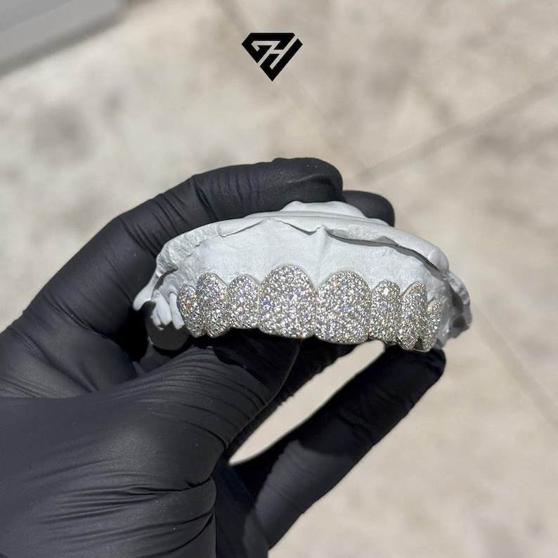 VVS Diamond Grillz - Custom Grillz - London Based - Perfect Fit - Etsy