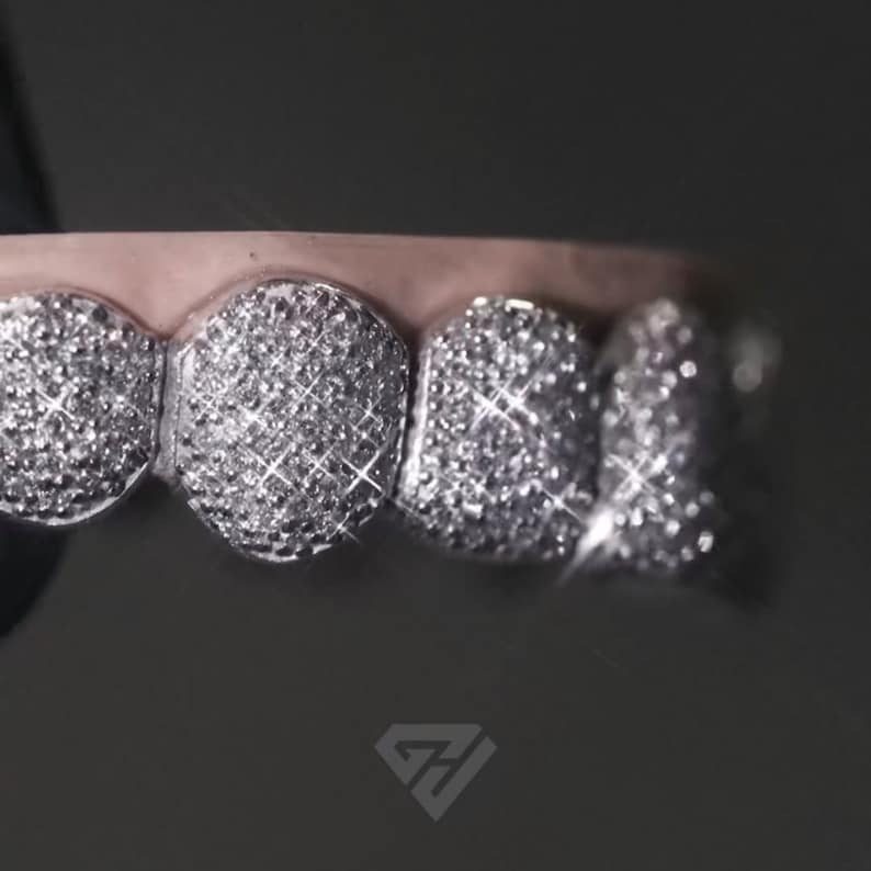 VVS Diamond Grillz - Custom Grillz - London Based - Perfect Fit - Etsy