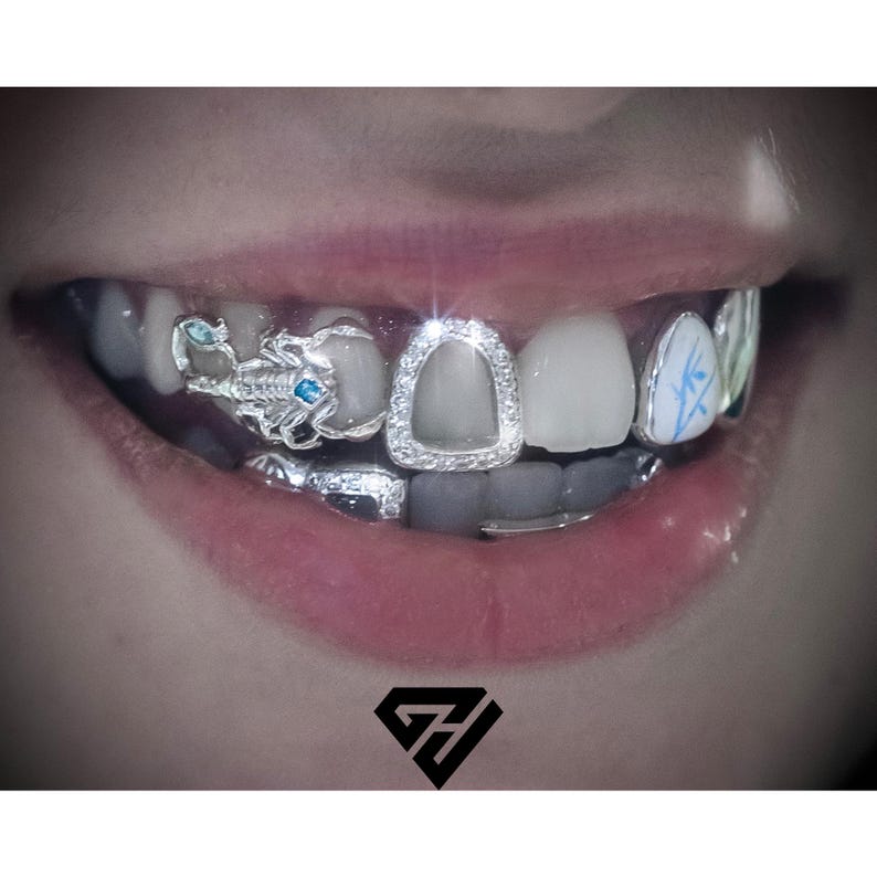 Fully Custom Complex Grillz - Handmade - Perfect Fit - Etsy