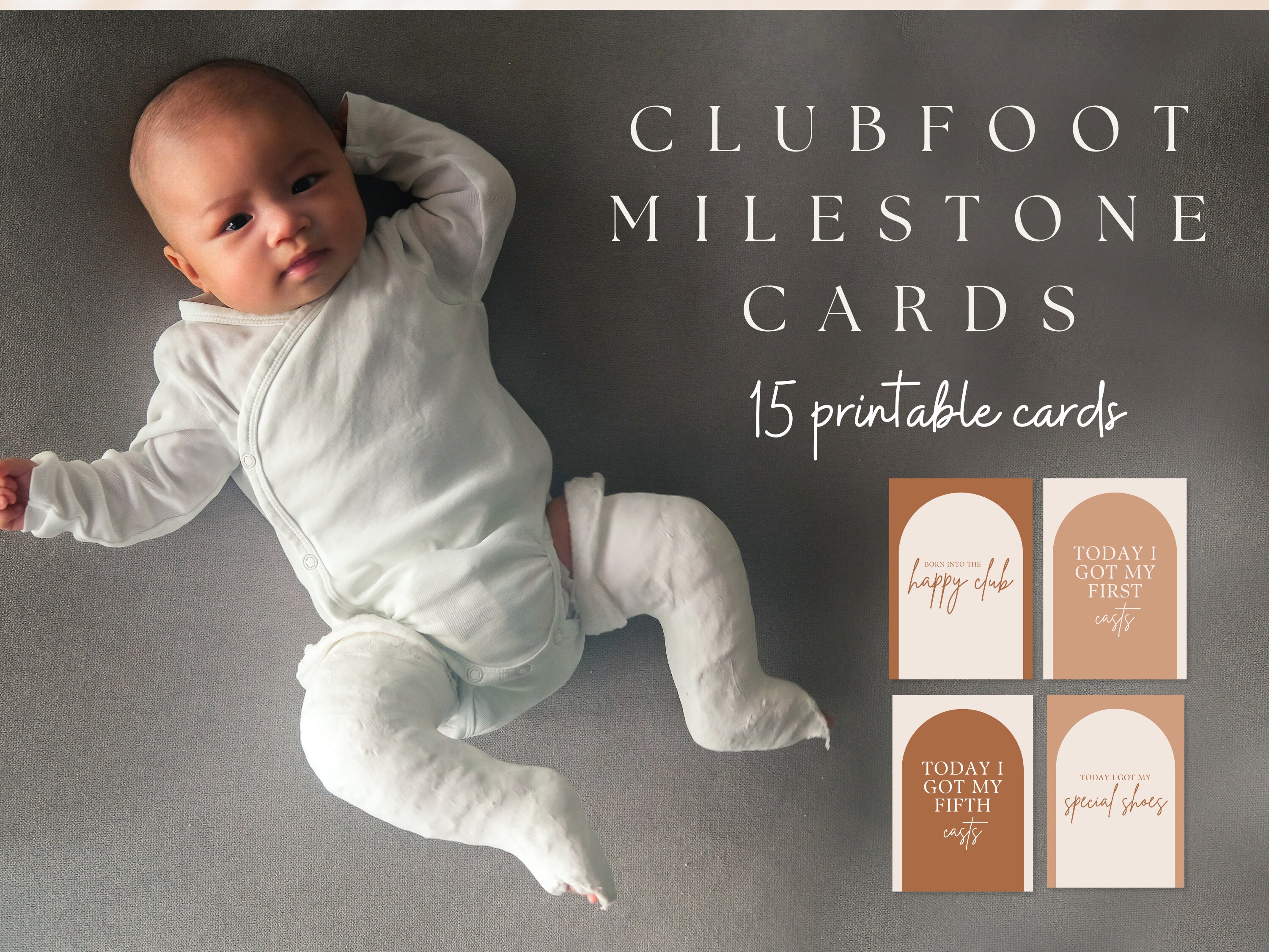 Printable Clubfoot Milestone Cards - Celebrate Every Step | Talipes ...