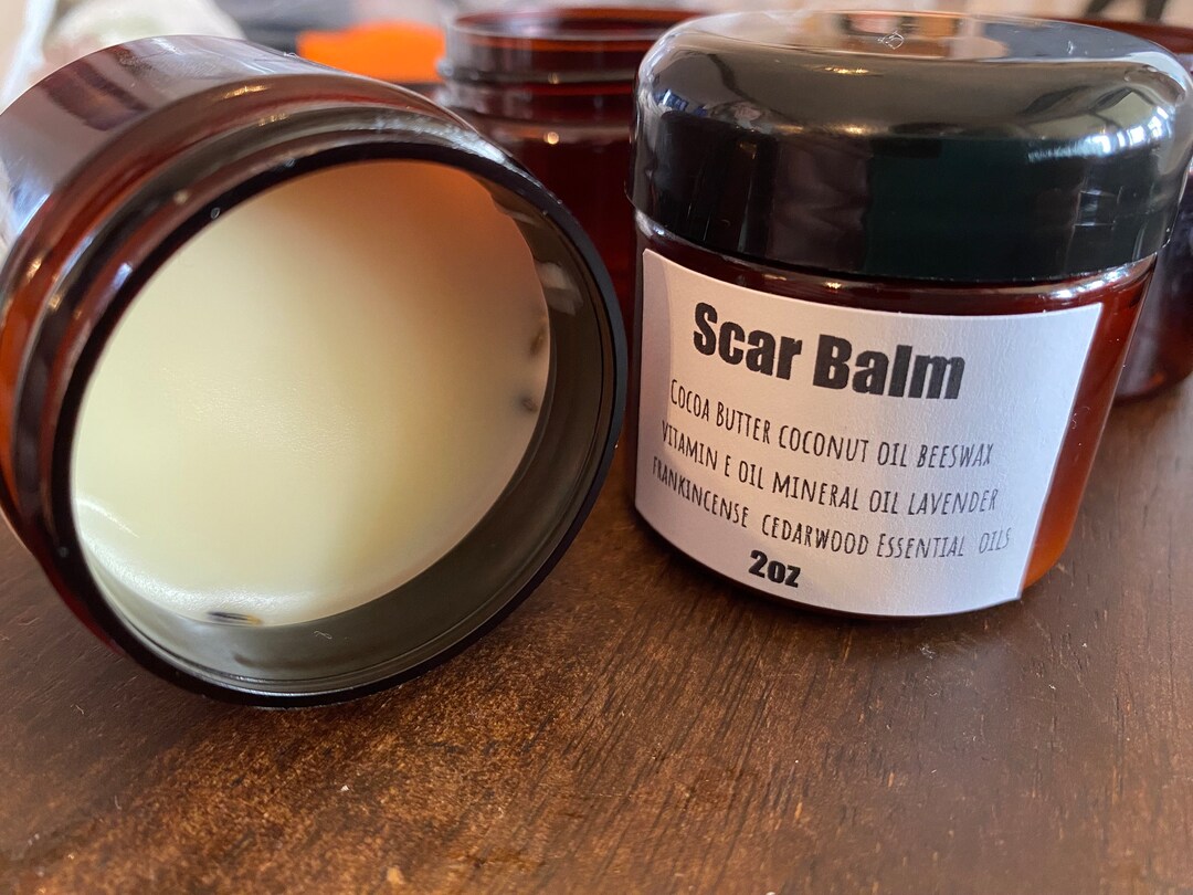 Scar Balm - Etsy