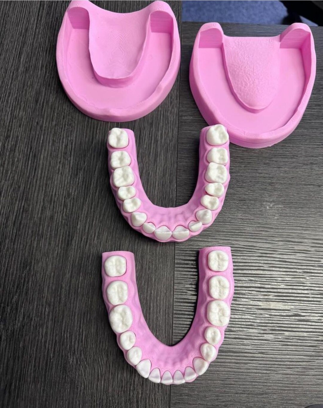 3D Printed Teeth and Gum Diagram - Etsy