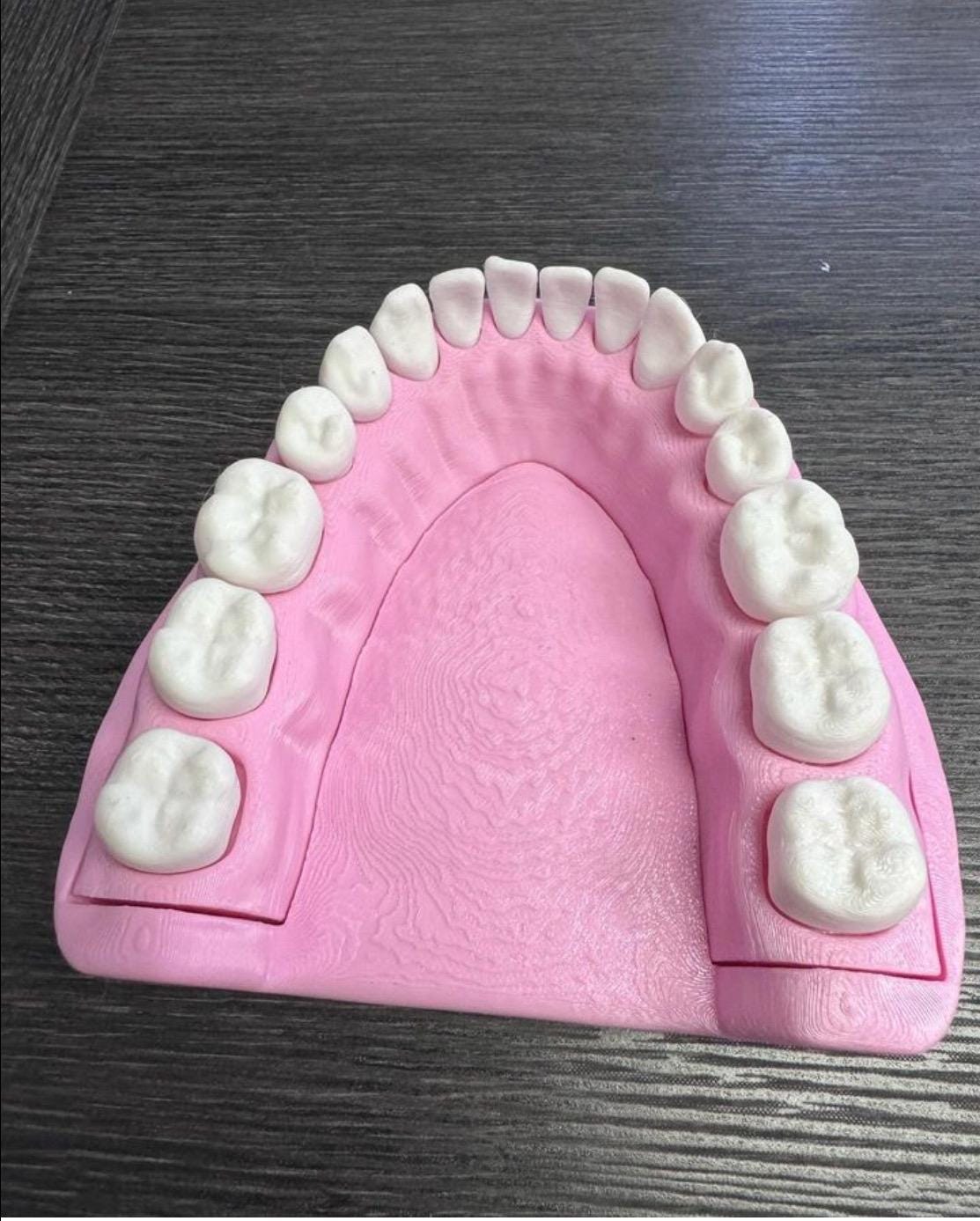 3D Printed Teeth and Gum Diagram - Etsy