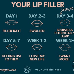 Lip Filler Journey/after Care - Etsy