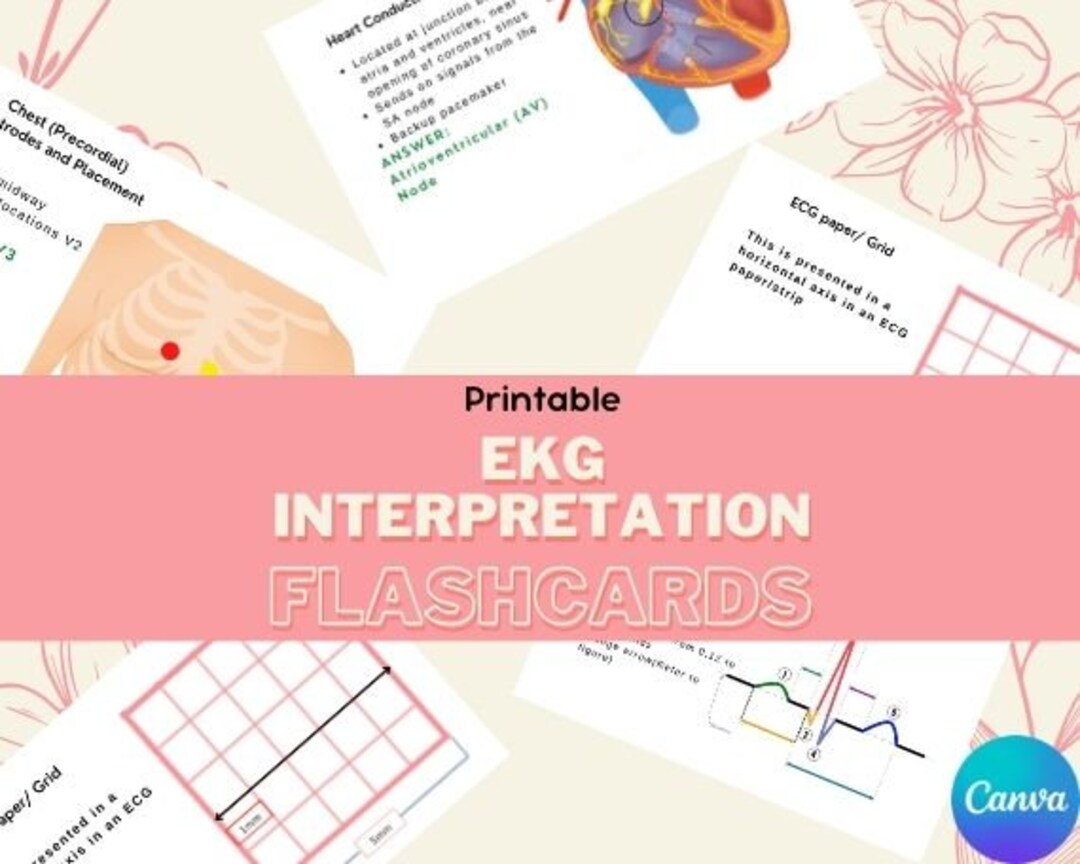 ECG/ EKG Flashcards, EKG Interpretation up to 100 Flashcards - Etsy ...