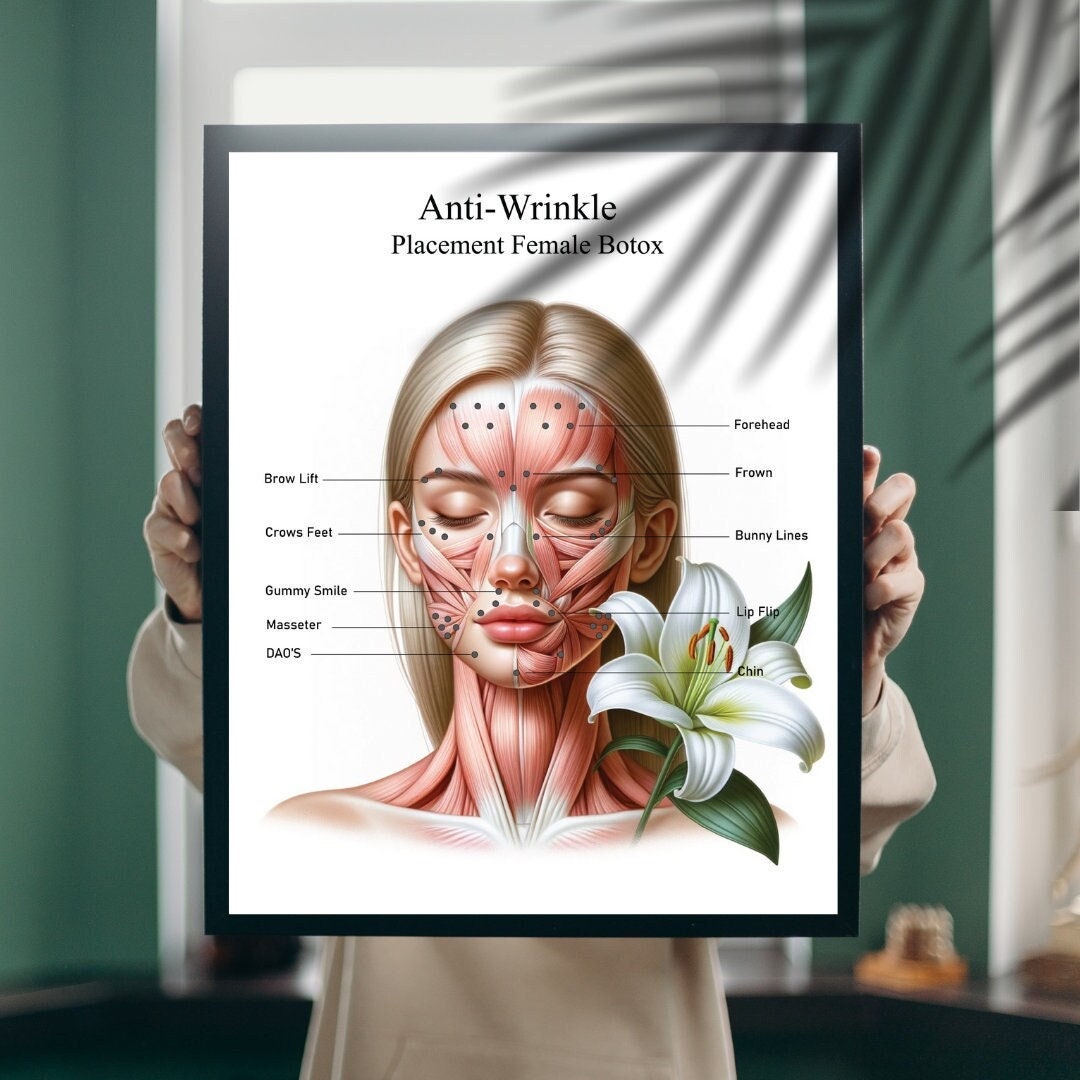 Facial Anatomy Art, Face Anatomy Poster, Facial Filler, Facial Muscles ...
