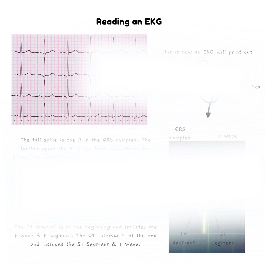Cardiovascular System and EKG Study Guide Bundle | Heart Anatomy, Blood ...