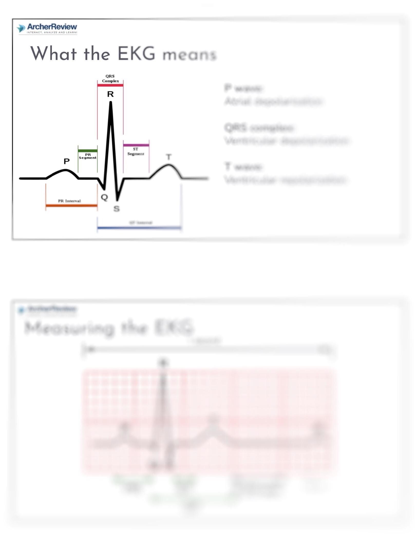 Archer Med Surg Cardiovascular Study Guide - Etsy