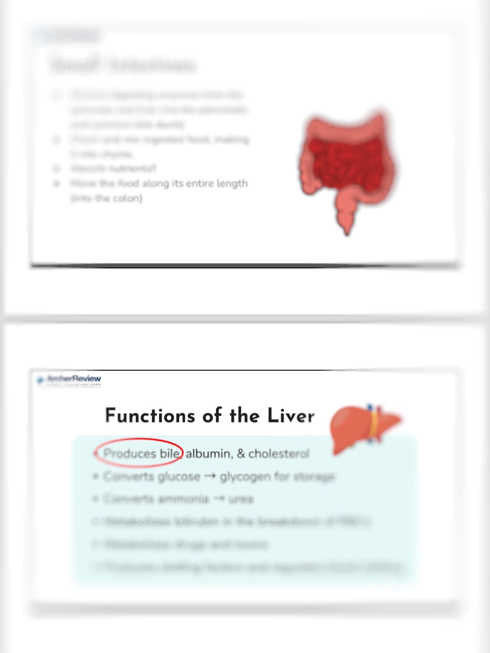 Archer Med Surg Gastrointestinal Study Guide - Etsy