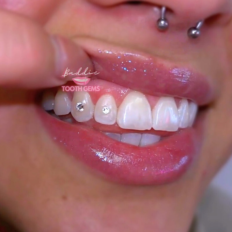 Crystal Tooth Gem Kits - Etsy