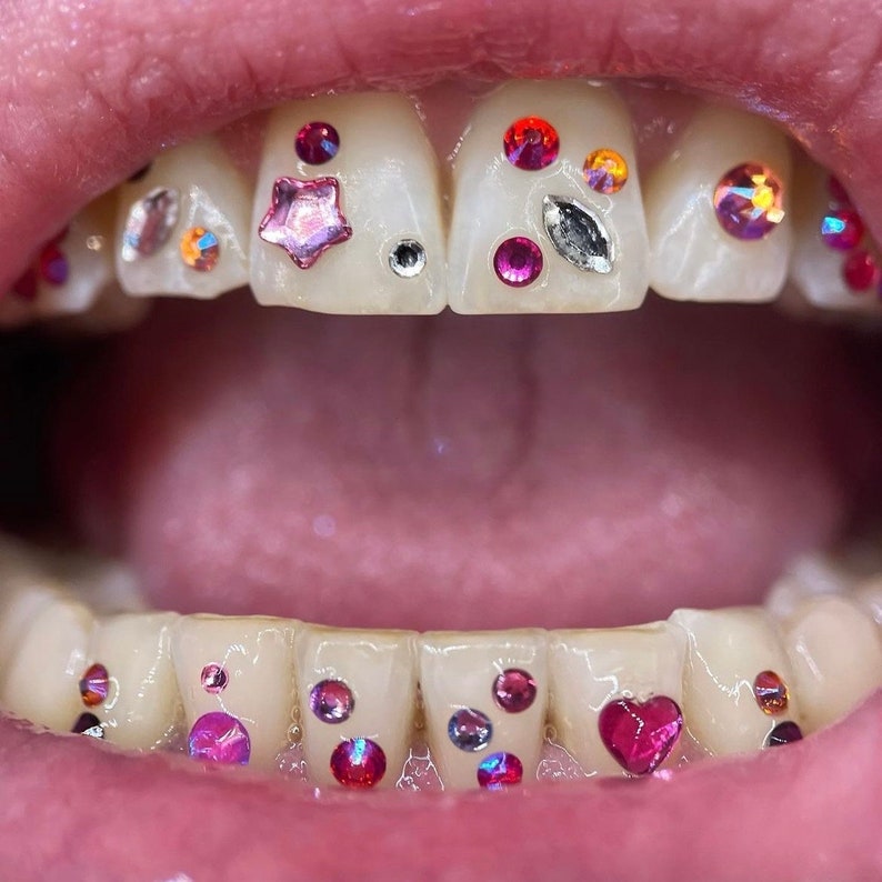 Professional DIY Tooth Gem Kit/at Home Tooth Gem Kit/swarovski Tooth ...